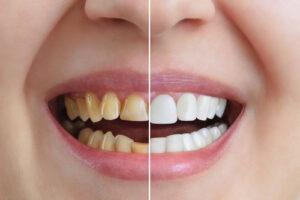 Best Dentist in Rajkot - Silver Smile Dental specialists