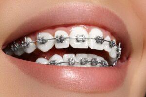 Best Dentist in Rajkot - Silver Smile Dental specialists